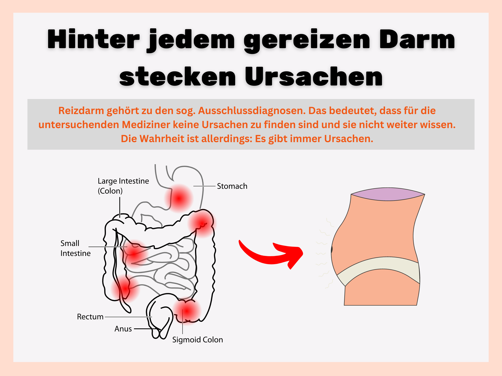 Ausschlussdiagnose Reizdarm: Auch dein Reizdarm hat Ursachen!
